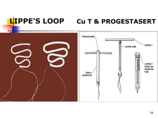 mathods of contraception | PPT | Birth Control | Reproductive Health