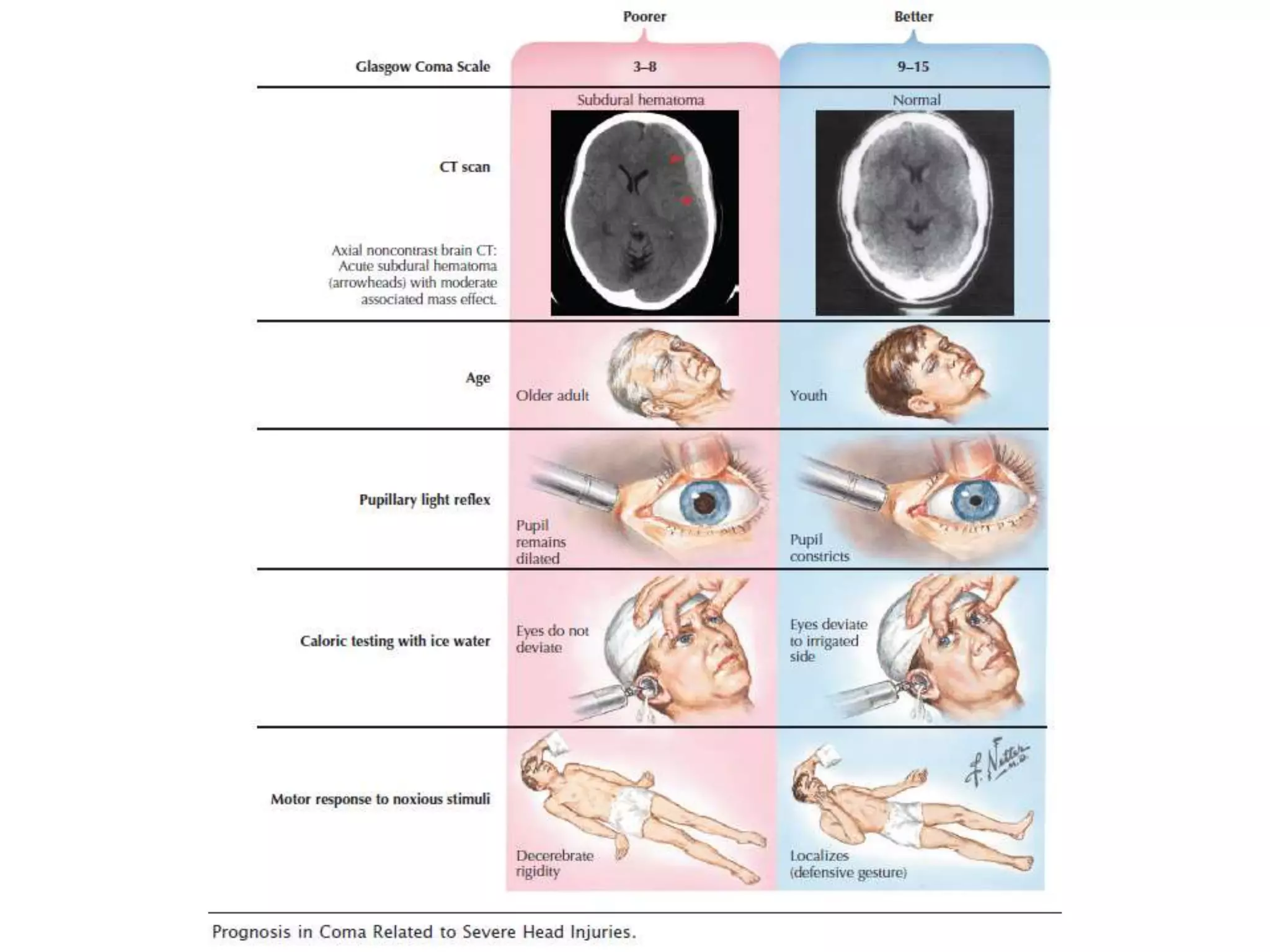 Mati batang otak mbo | PPTX