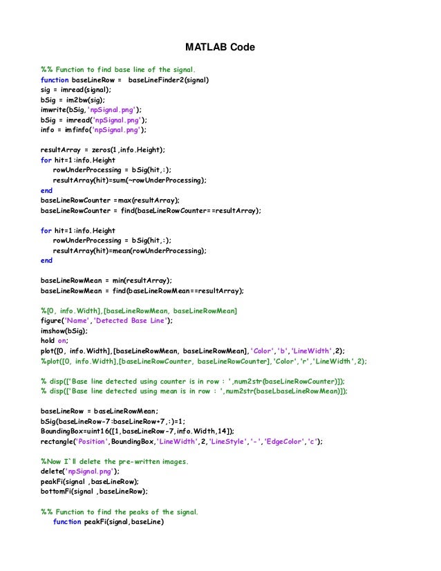 MATLAB Code + Description : ECG Signal Peaks/Bottoms Finder Using ...