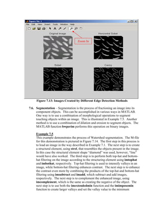 Mat-lab image processing tatorial | PDF