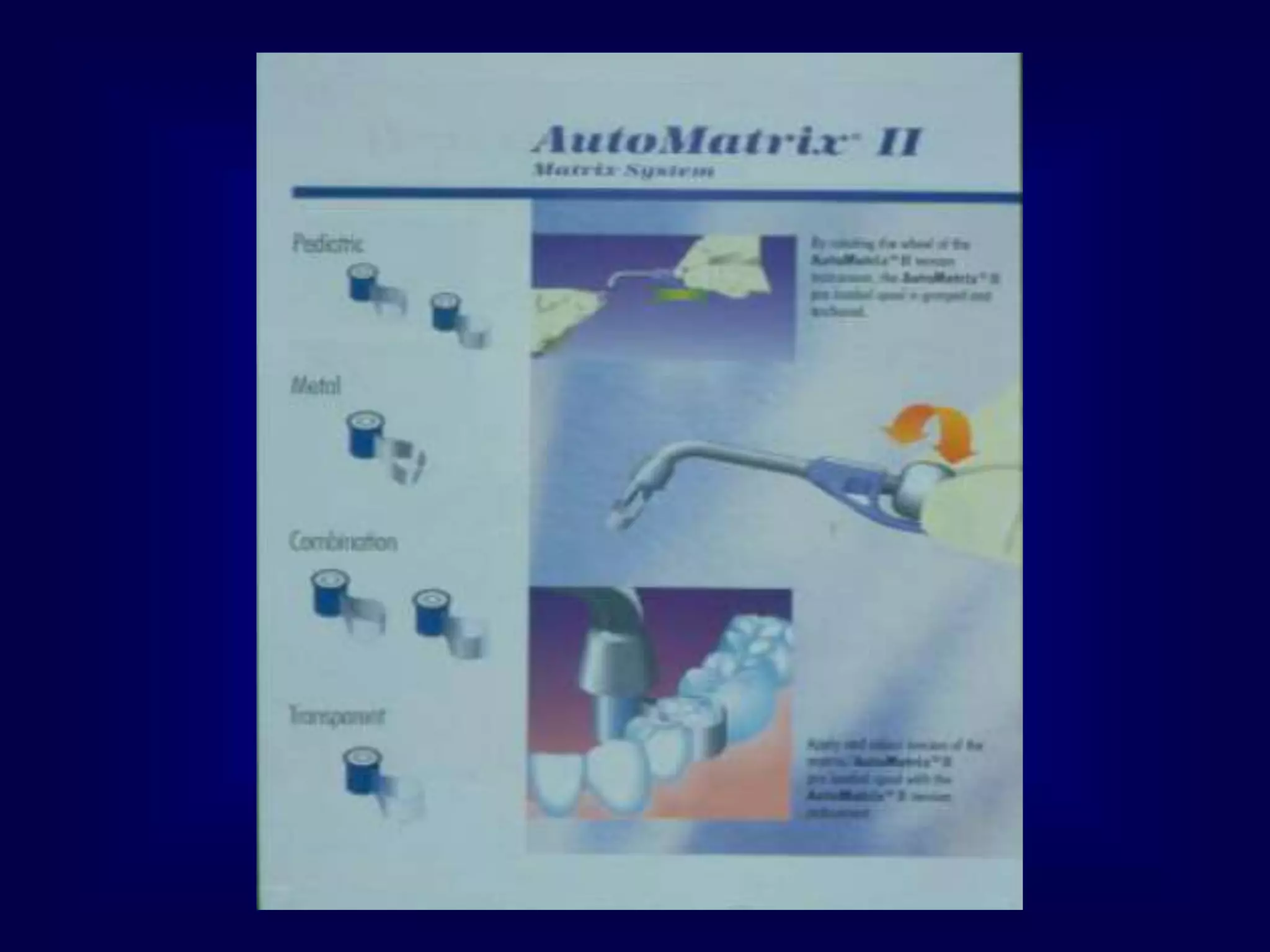 Matrices in-pediatric-restorative-dentistry | PPTX