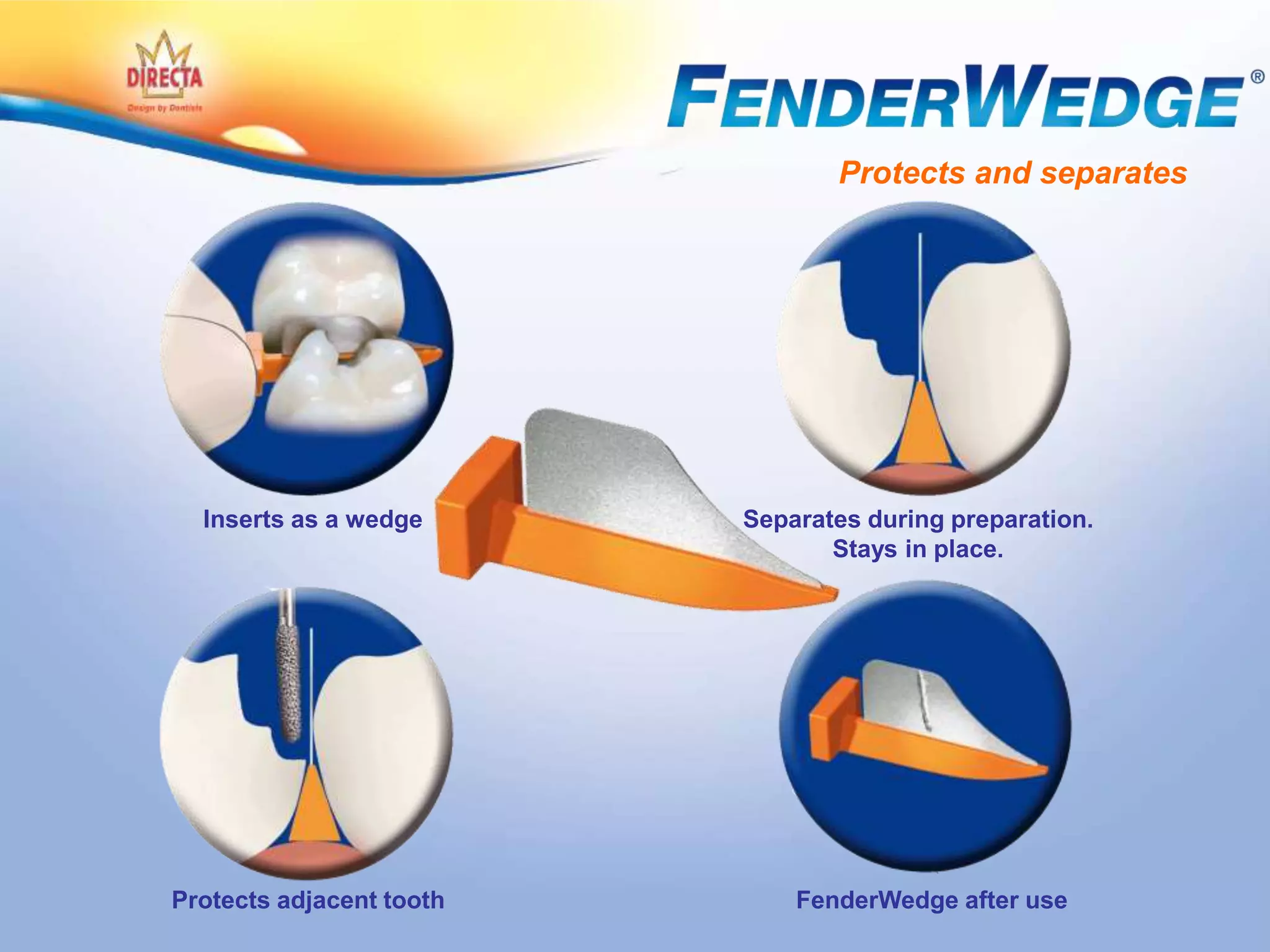 Matrices in-pediatric-restorative-dentistry | PPTX