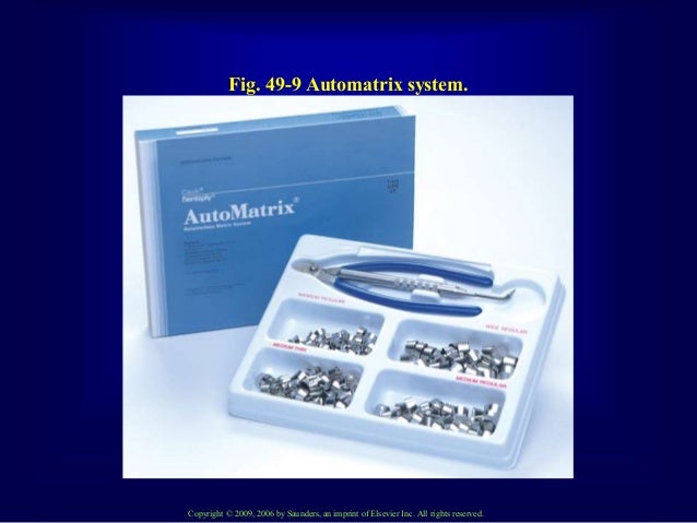 Matrices in-pediatric-restorative-dentistry