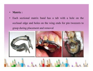 Matrix Band Placement