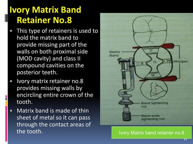 Matrices, retainers, wedges and separators | PPT | Dental Health ...