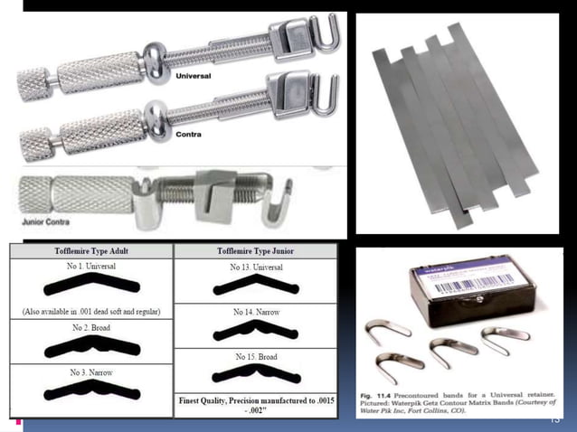 Matrices, retainers, wedges and separators | PPT | Dental Health ...