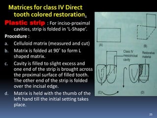 Matrices, retainers, wedges and separators | PPT