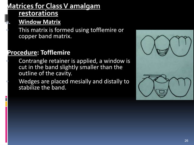 Matrices, retainers, wedges and separators | PPT | Dental Health ...