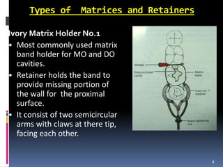 Matrices, retainers, wedges and separators | PPT