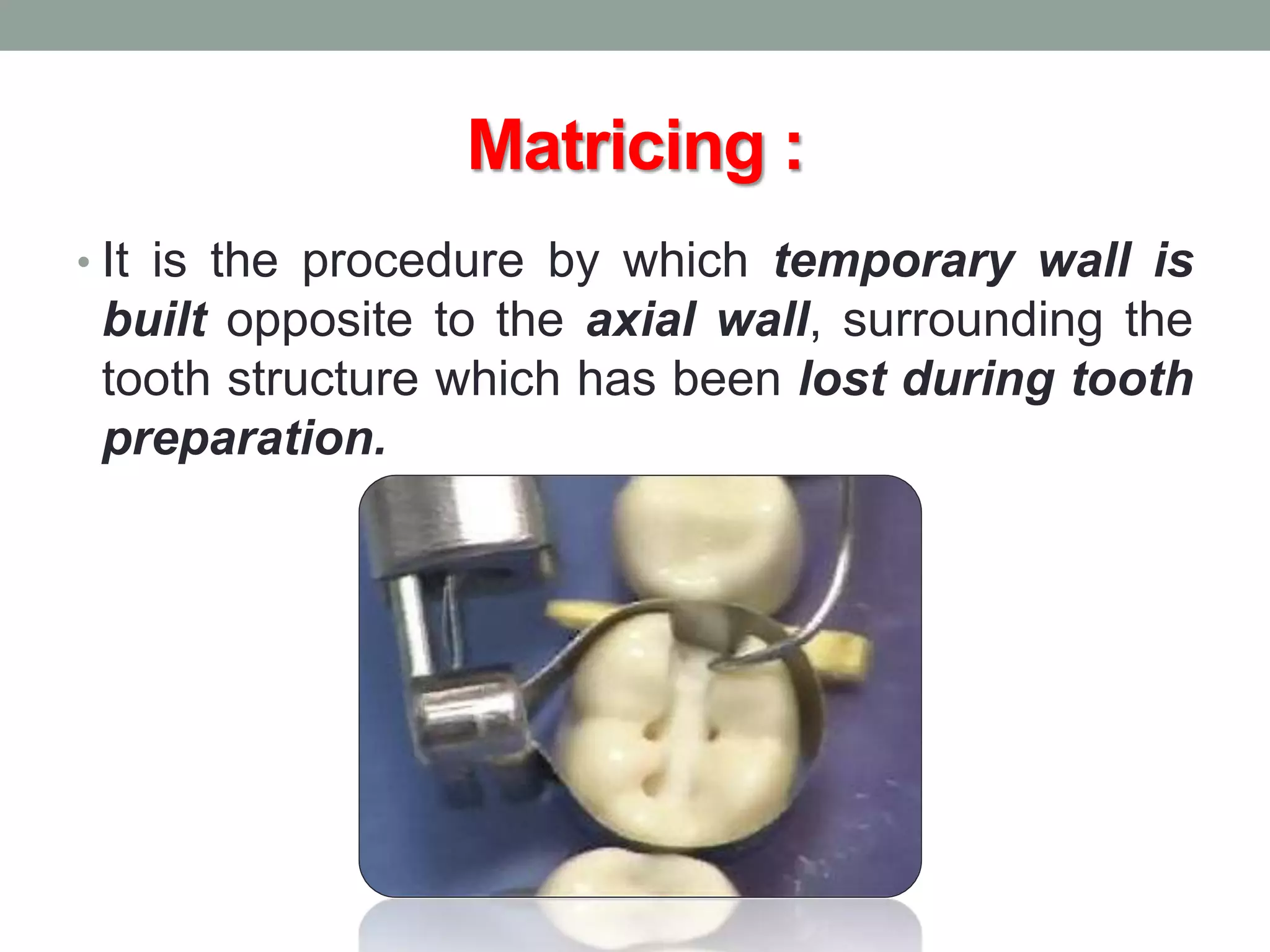 Matricing and tooth separation | PPTX