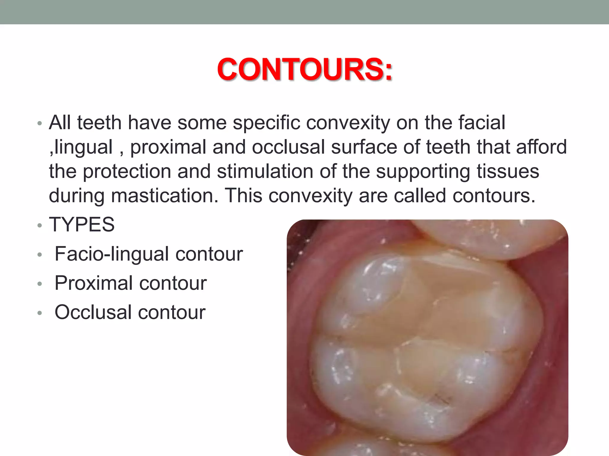 Matricing and tooth separation | PPTX