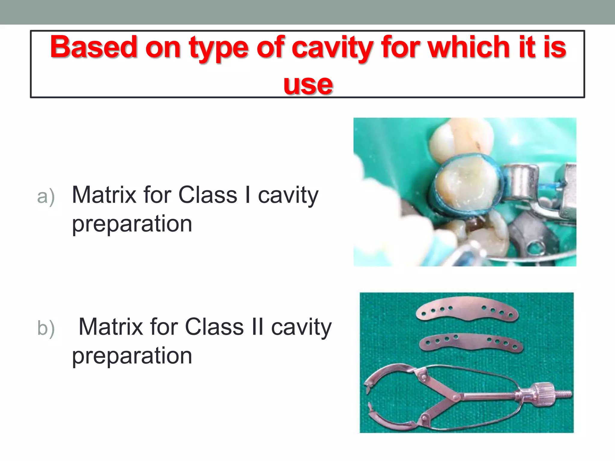 Matricing and tooth separation | PPTX