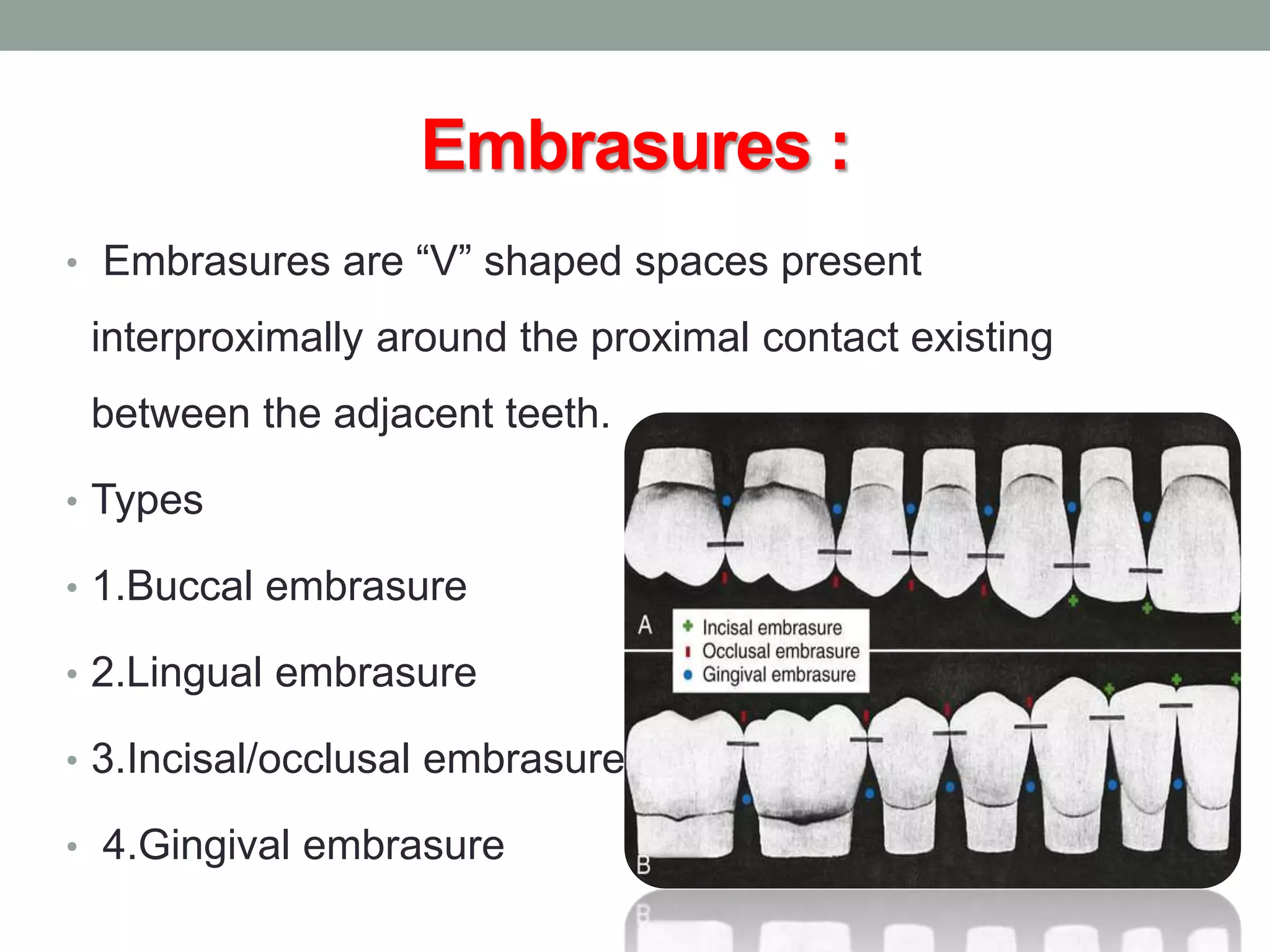 Matricing and tooth separation | PPTX