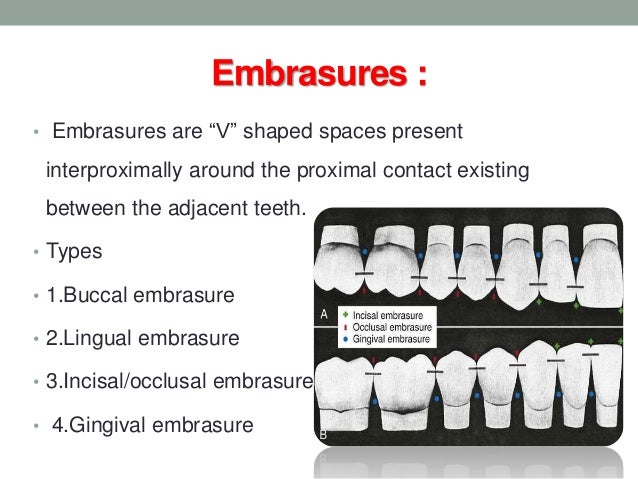 Matricing and tooth separation
