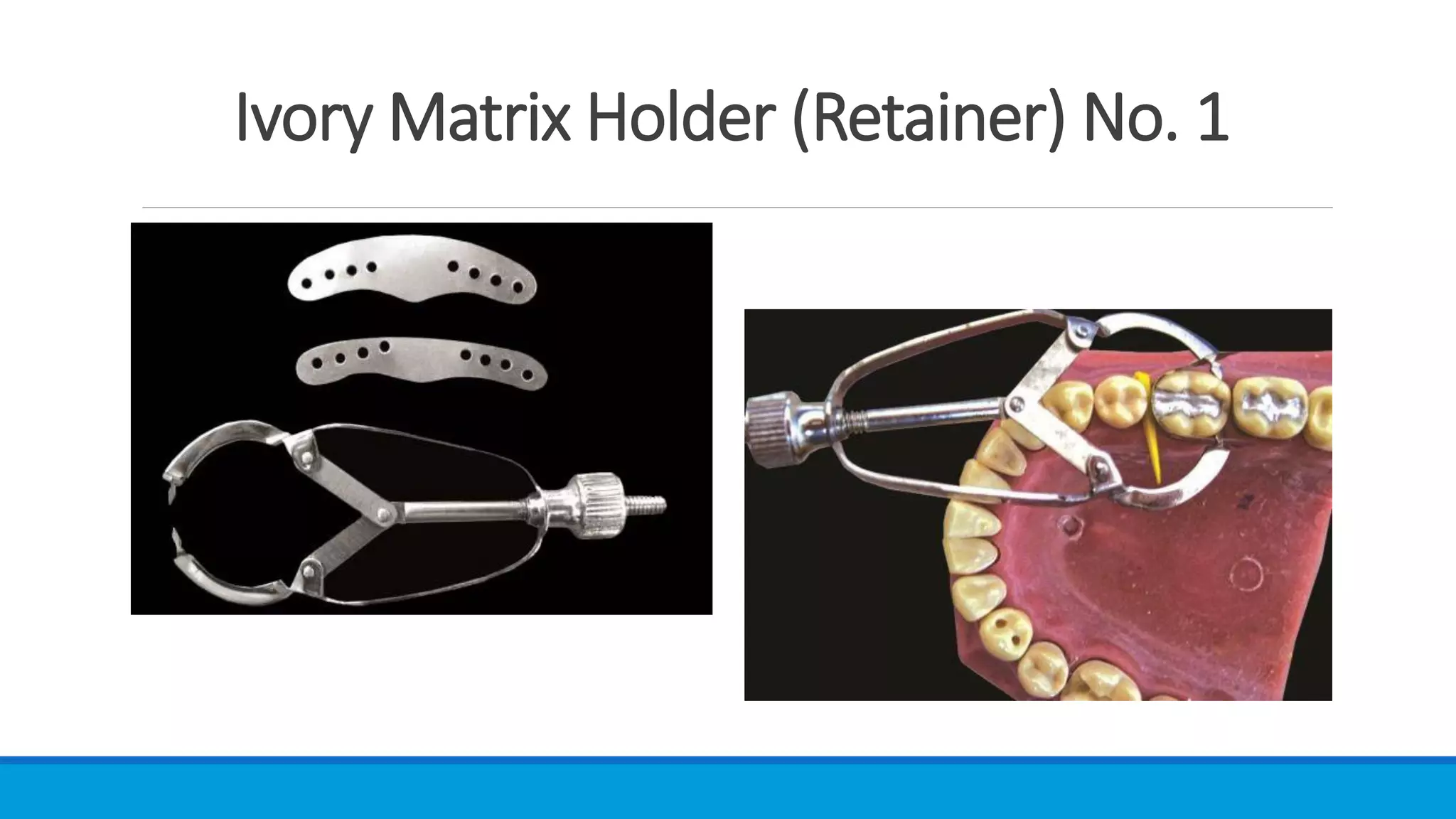 Matricing & Tooth Separation | PDF