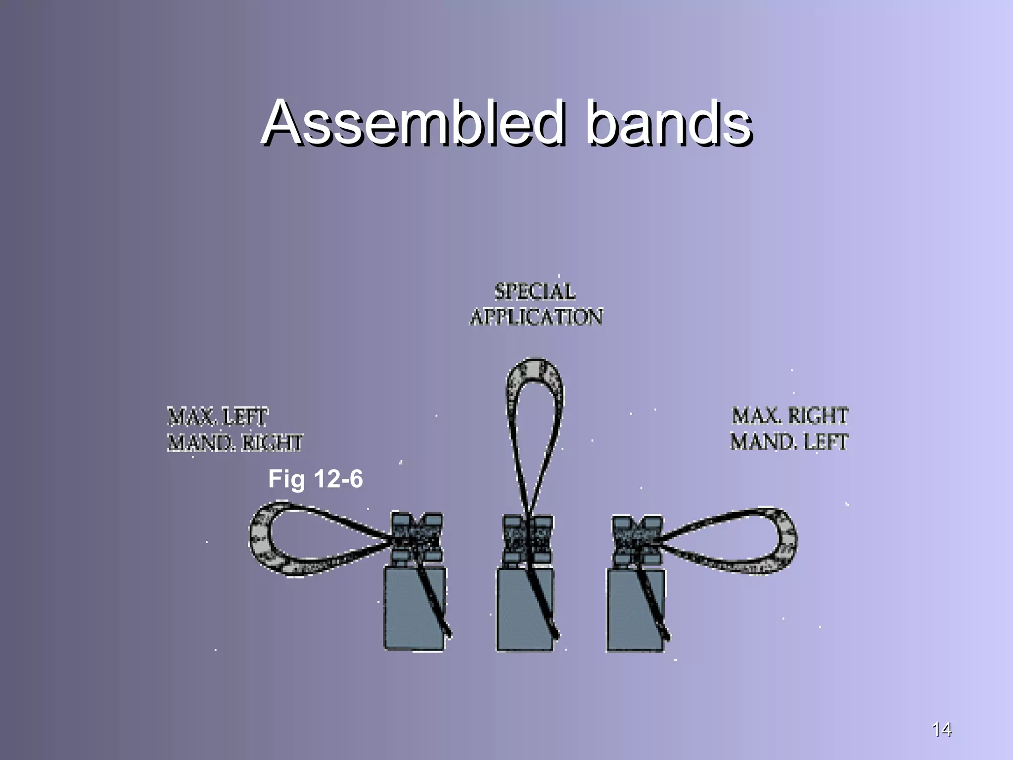 Matrix bands | PPT