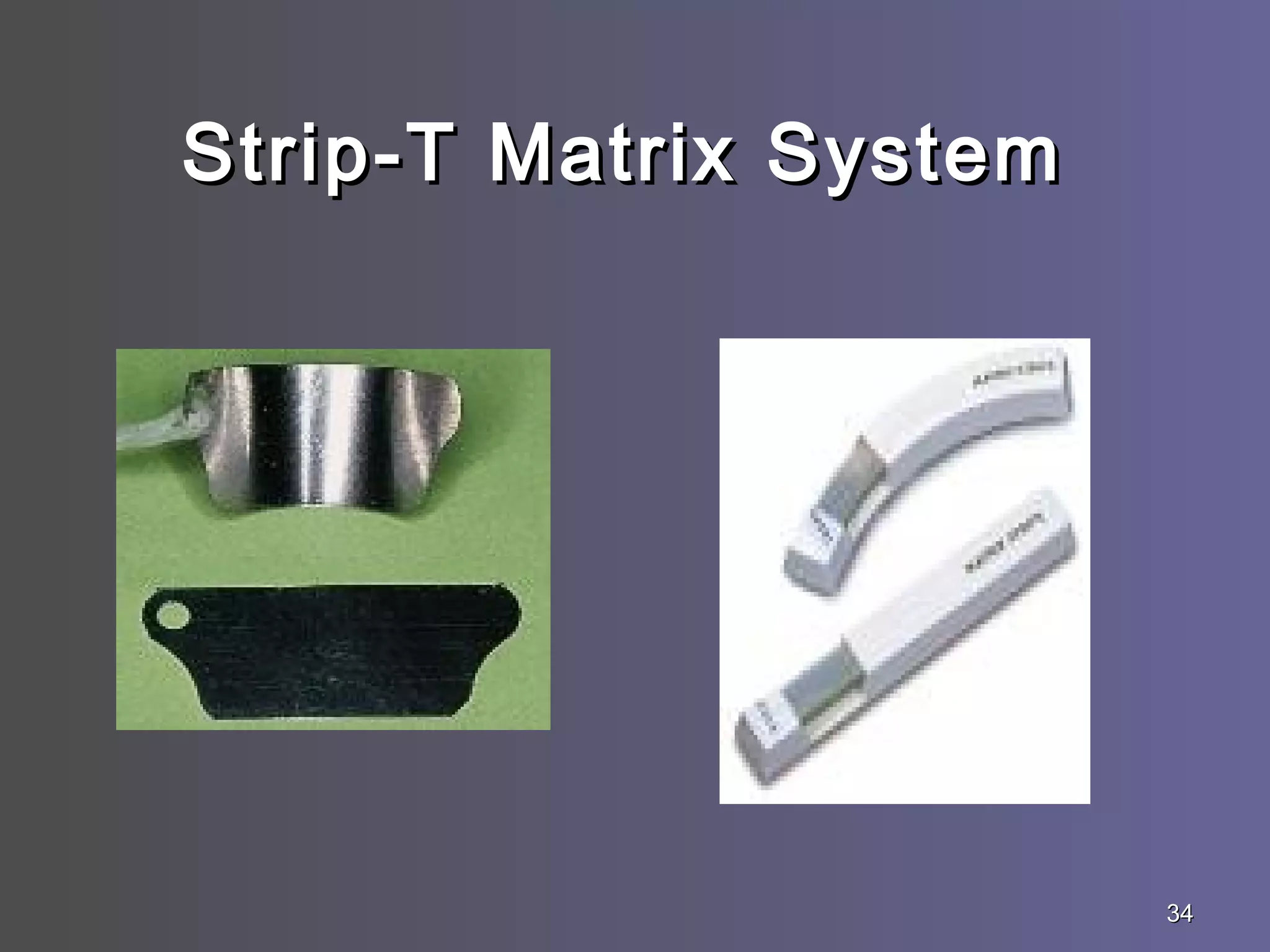 Matrix bands | PPT