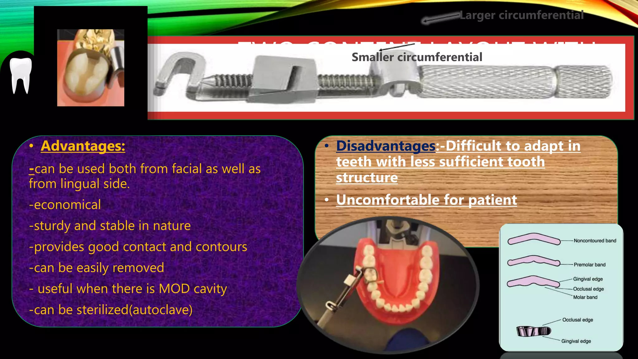 Matrix band system by Dr.Aisha Jamil | PPTX | Dental Health | Diseases ...