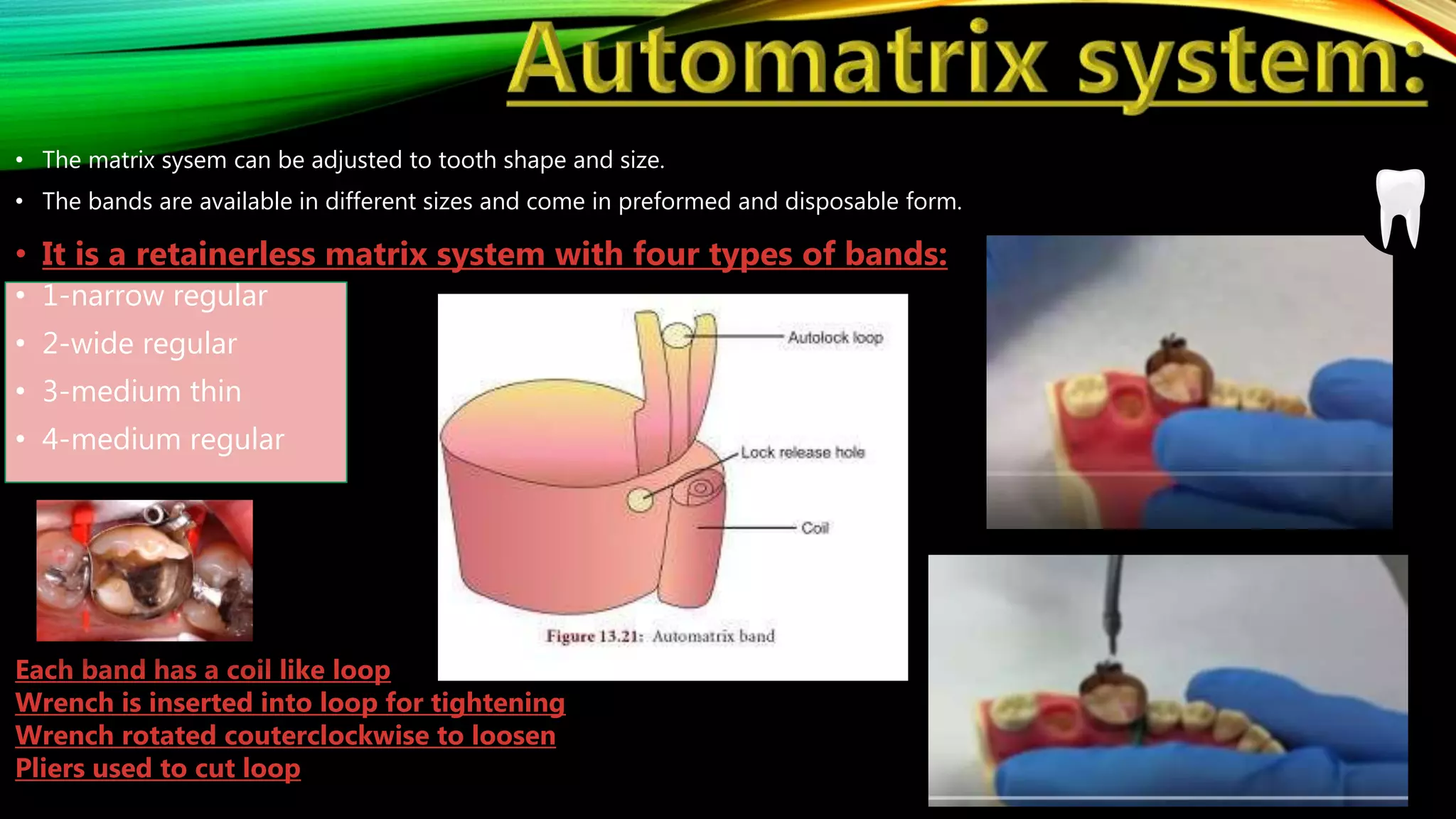 Matrix band system by Dr.Aisha Jamil | PPTX