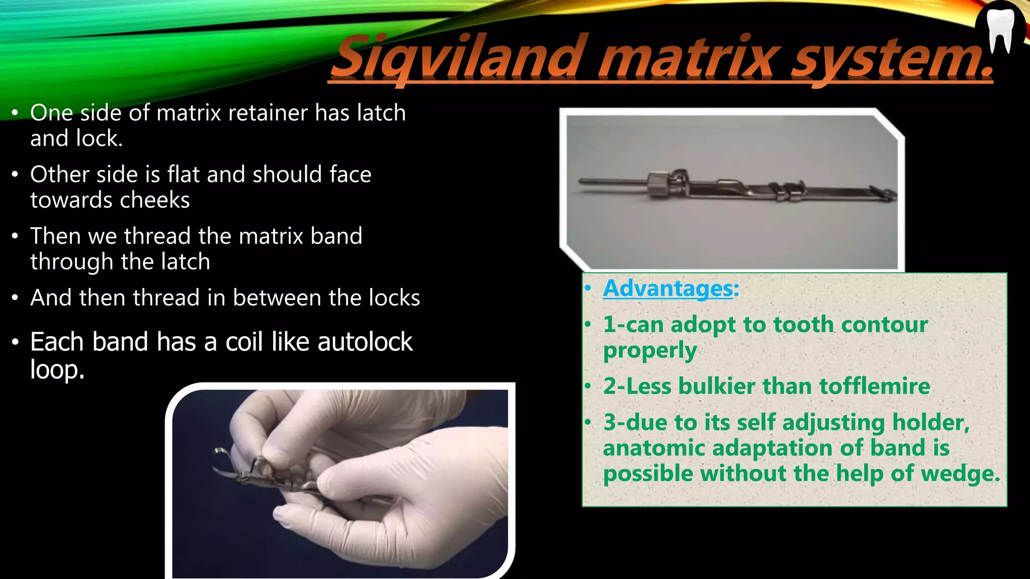 Matrix band system by Dr.Aisha Jamil | PPT