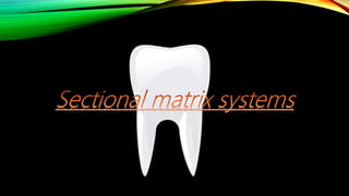 Matrix band system by Dr.Aisha Jamil | PPTX