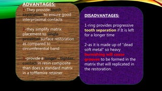 Matrix band system by Dr.Aisha Jamil | PPTX