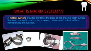 Matrix band system by Dr.Aisha Jamil | PPTX