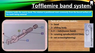 Matrix band system by Dr.Aisha Jamil | PPTX