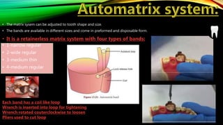Matrix band system by Dr.Aisha Jamil | PPTX