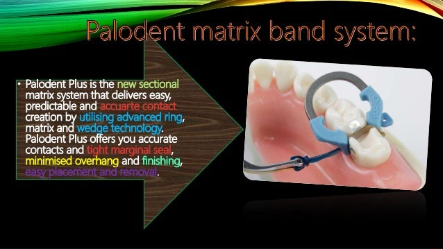 Matrix band system by Dr.Aisha Jamil