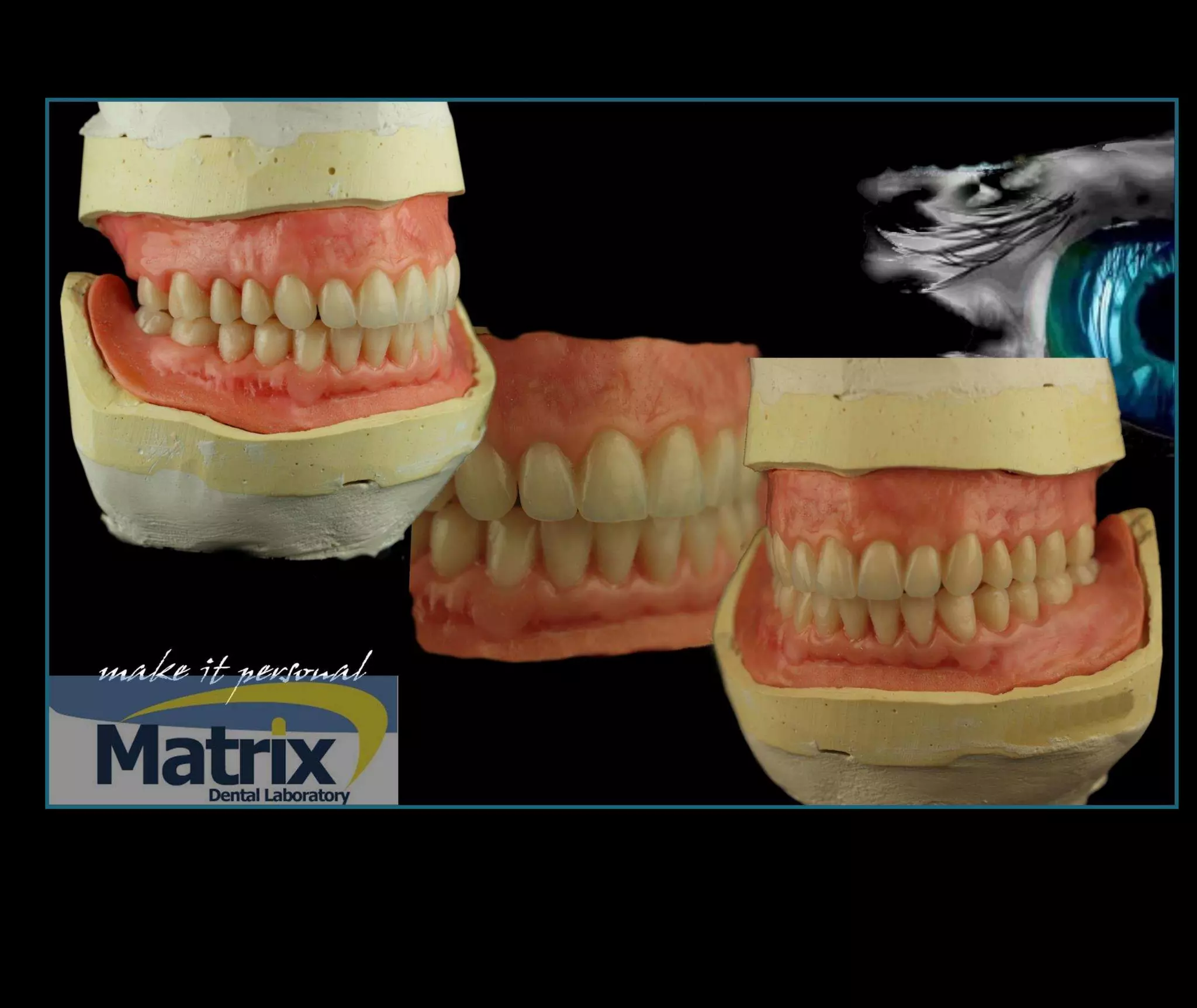 Matrix Dental Laboratory and Consulting | PDF