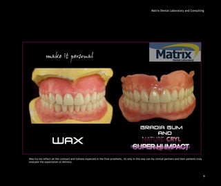 Matrix Dental Laboratory and Consulting | PDF