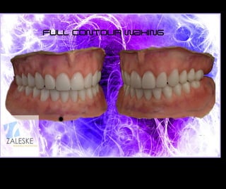 Matrix Dental Laboratory and Consulting | PDF