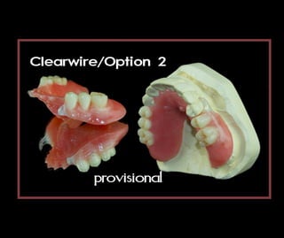 Matrix Dental Laboratory and Consulting | PDF