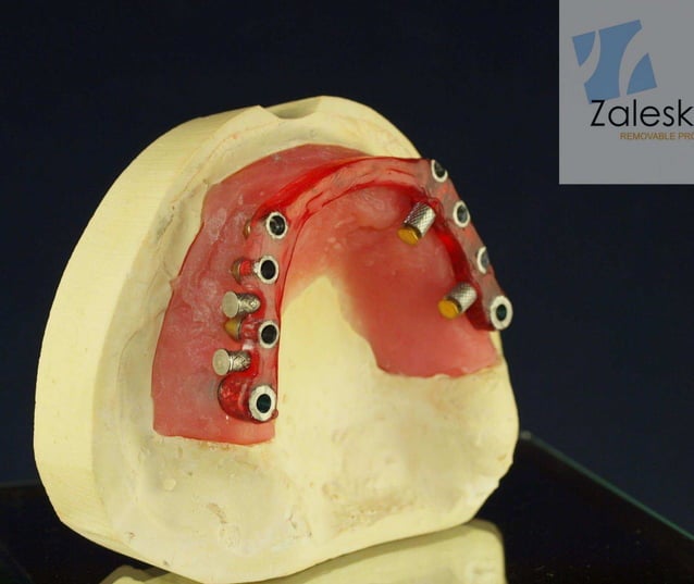 Matrix Dental Laboratory and Consulting | PDF