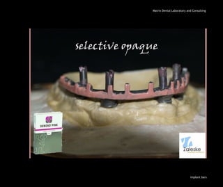 Matrix Dental Laboratory and Consulting | PDF