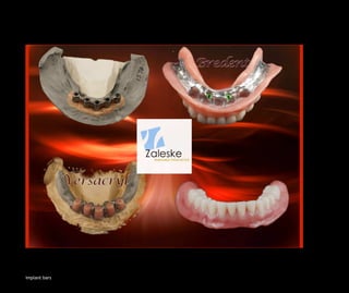 Matrix Dental Laboratory and Consulting | PDF