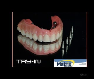 Matrix Dental Laboratory and Consulting | PDF
