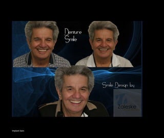 Matrix Dental Laboratory and Consulting | PDF