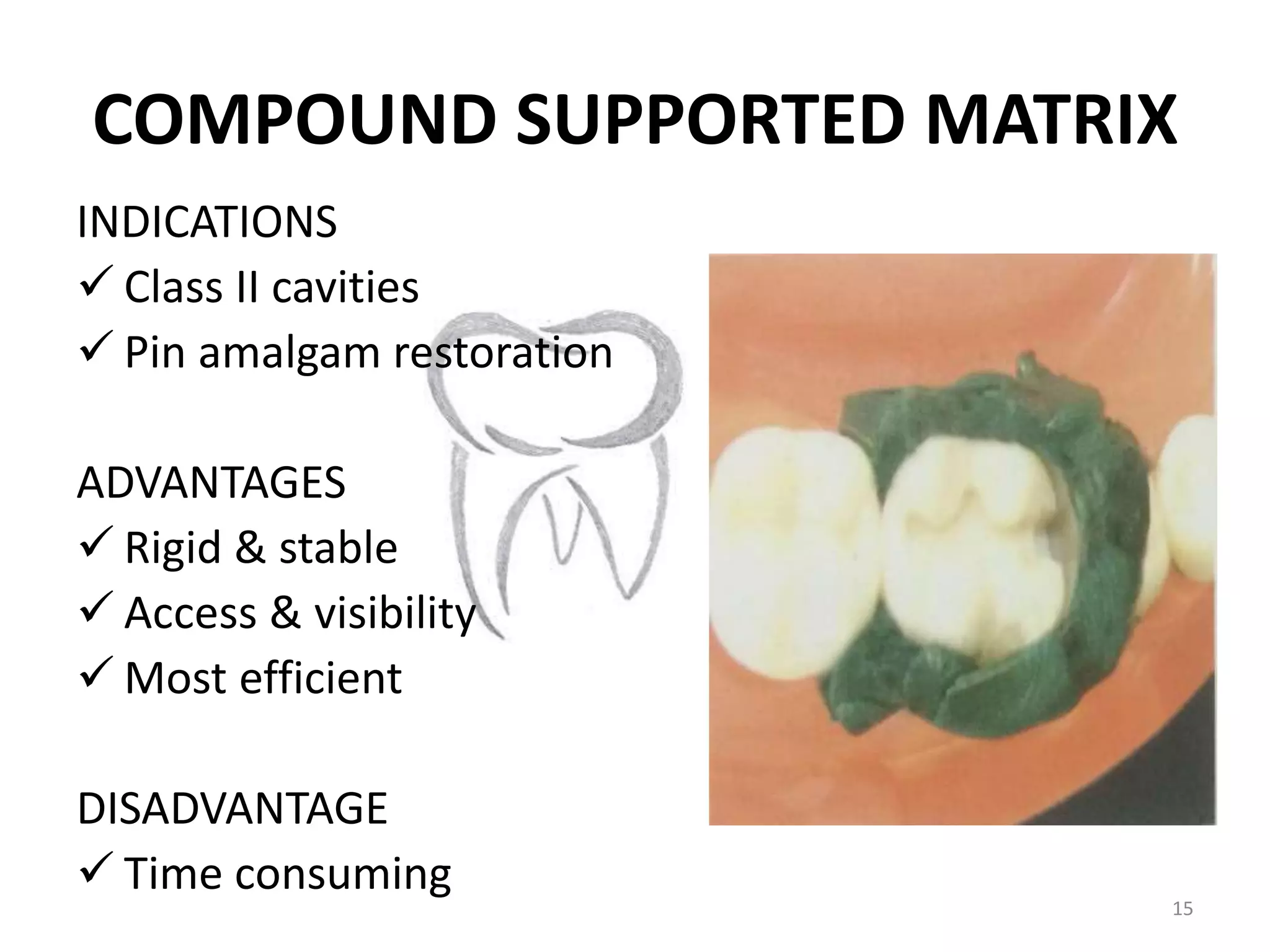 Matrixing and wedges | PPTX