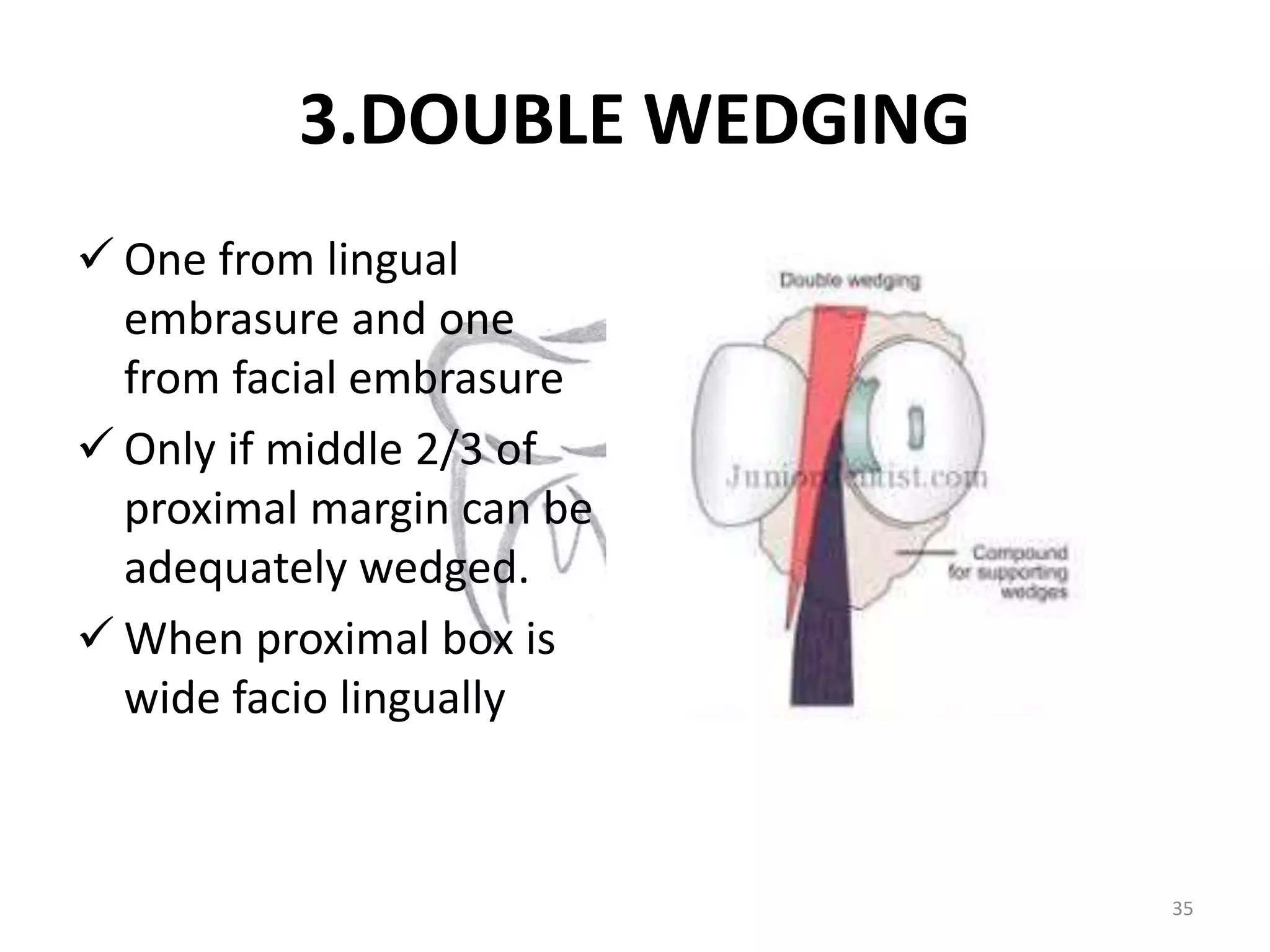 Matrixing and wedges | PPTX
