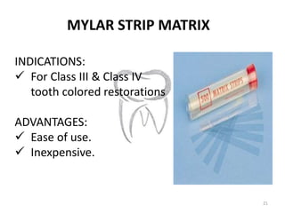 Matrixing and wedges | PPTX
