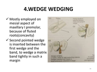 Matrixing and wedges | PPTX