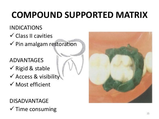 Matrixing and wedges