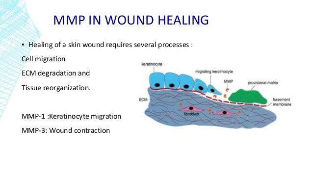 Matrix metalloproteinases