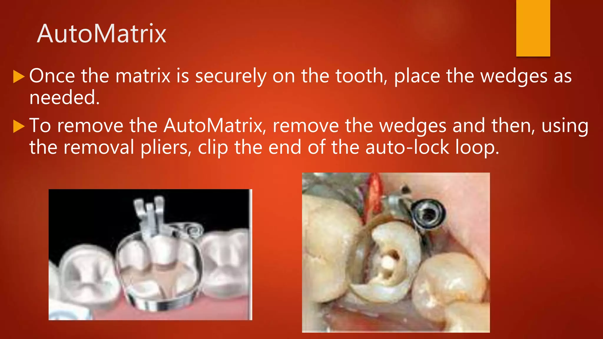 Matrix Systems | PPTX