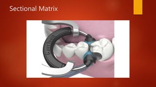 Matrix Systems | PPTX