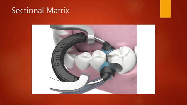 Matrix Systems | PPTX