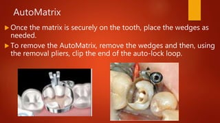 Matrix Systems | PPT