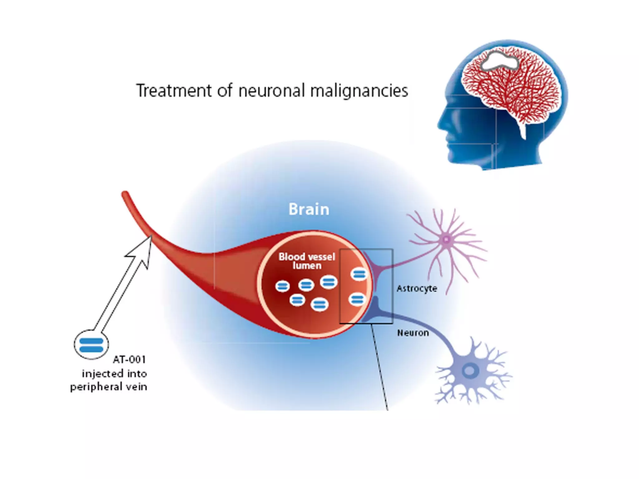 Dr Matthew Campbell - AGM 2011 - AMD Drug Delivery | PPT | Free Download